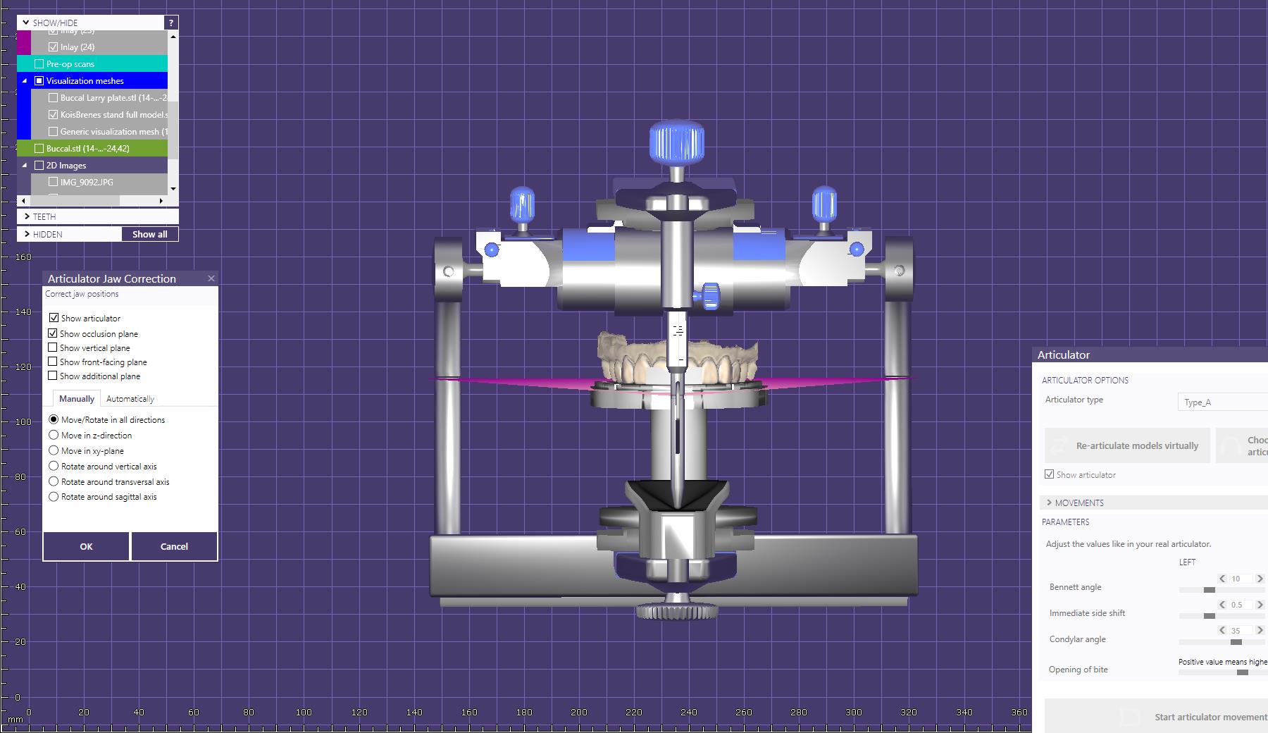 Digital face-bow transfer technique dentofacial analyser for dental ...